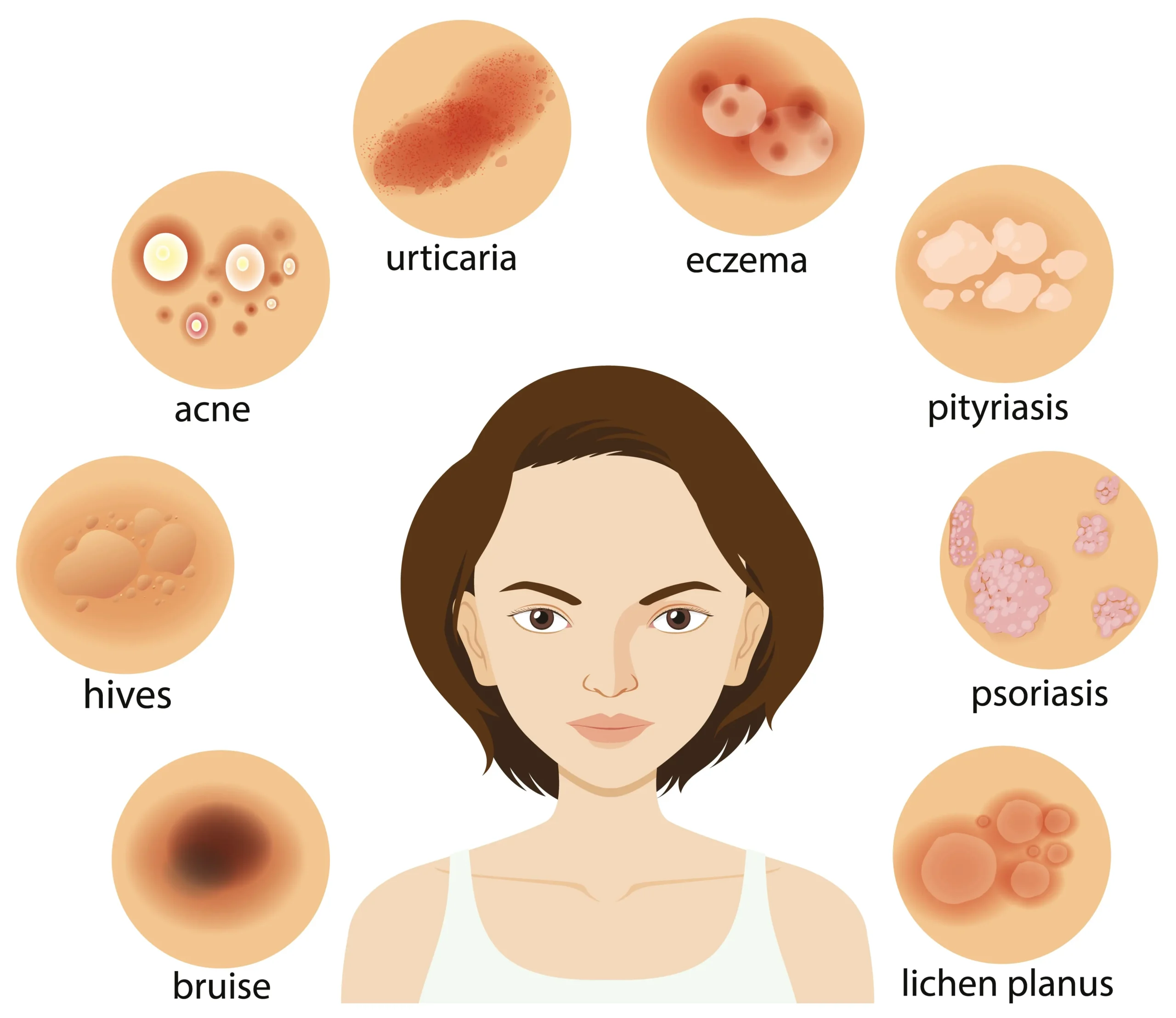 Découvrez les Secrets des Maladies Rares de la Peau - Conseils Sante